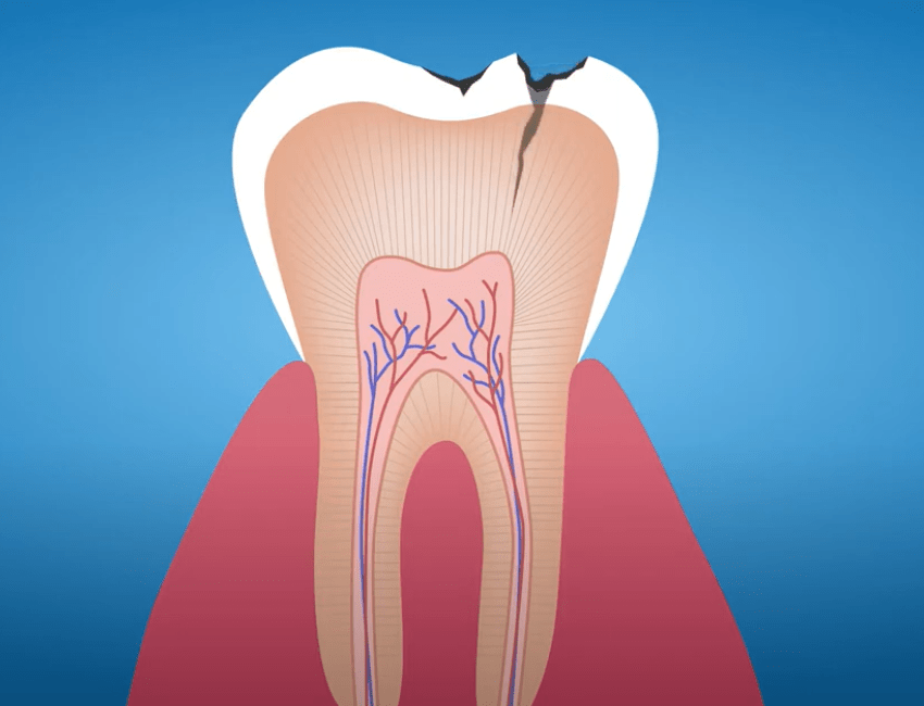 Health Info | National Institute of Dental and Craniofacial Research