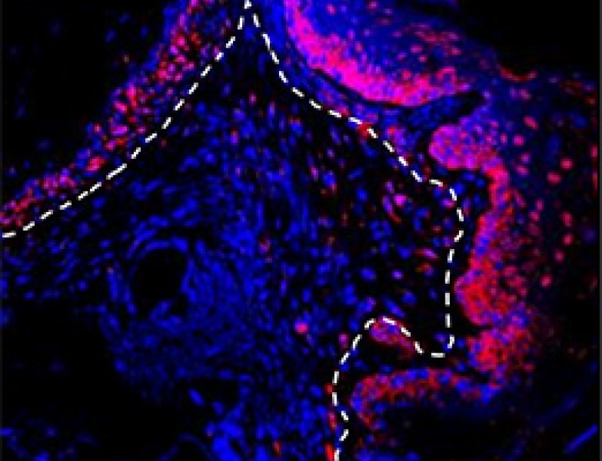 News & Events | National Institute of Dental and Craniofacial Research